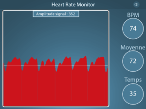 EC6502 Principles of Digital Signal Processing Important questions